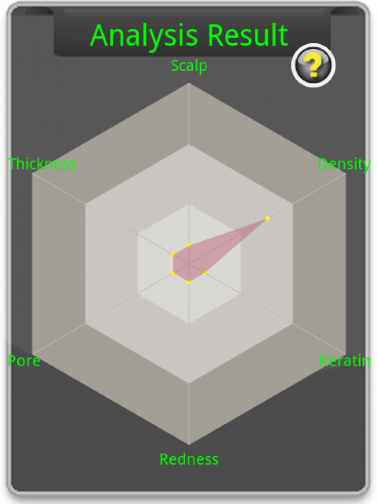 device-2017-11-21-164835 - ARAM HUVIS